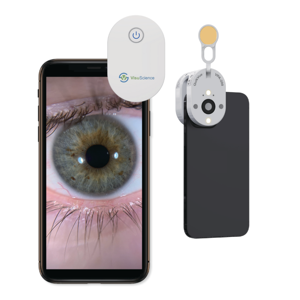 Oftalmoscop digital portabil - Oftalmoscop digital - ROOFT